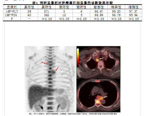 18F-FLT和18F-FDG PET/CT对胸段食管癌淋巴结分期诊断的比较分析--中国期刊网